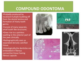 ODONTOMA | PPTX