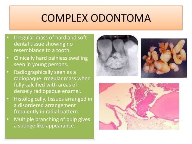 ODONTOMA | PPTX