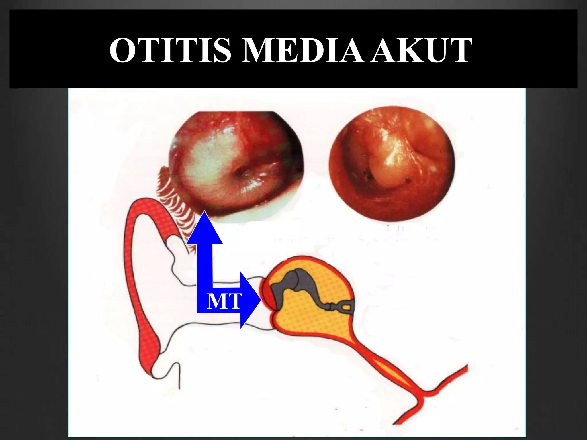 OMSK_DAN_MASTOIDITIS.pptx