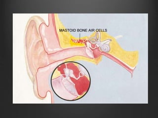 OMSK_DAN_MASTOIDITIS.pptx