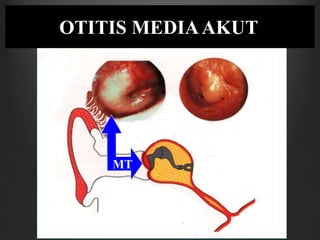 OMSK_DAN_MASTOIDITIS.pptx