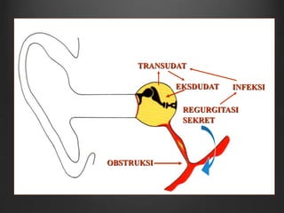OMSK_DAN_MASTOIDITIS.pptx