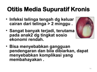 penyakit penyakit pada telinga OMSK dan OMA.ppt