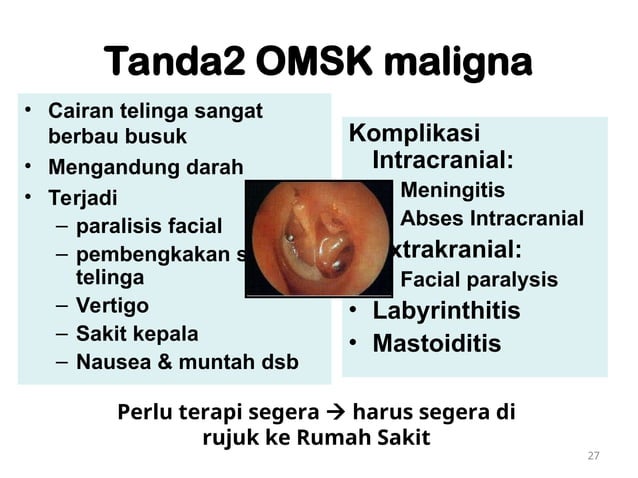 penyakit penyakit pada telinga OMSK dan OMA.ppt
