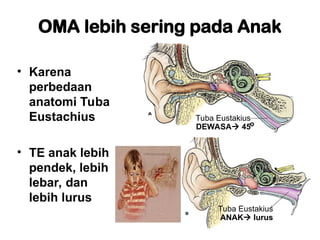penyakit penyakit pada telinga OMSK dan OMA.ppt