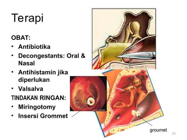 penyakit penyakit pada telinga OMSK dan OMA.ppt