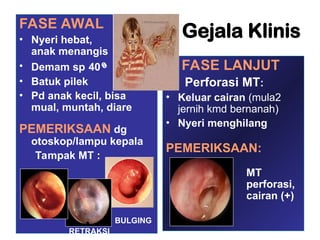 penyakit penyakit pada telinga OMSK dan OMA.ppt