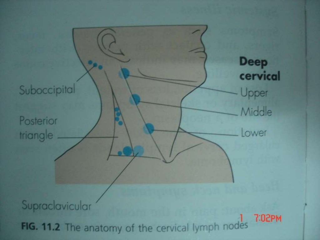 Neck mass