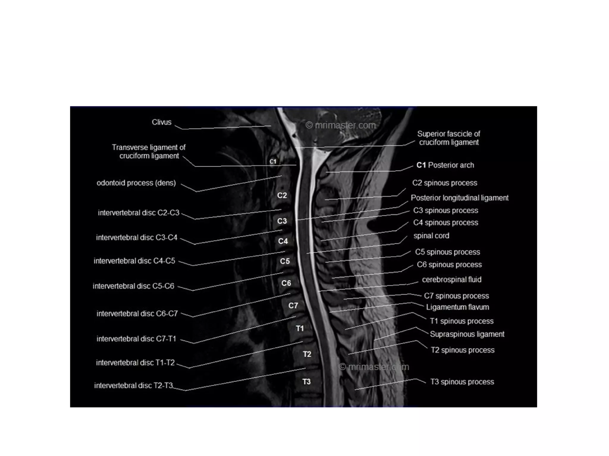 Omurga anatomi̇si̇ | PPT