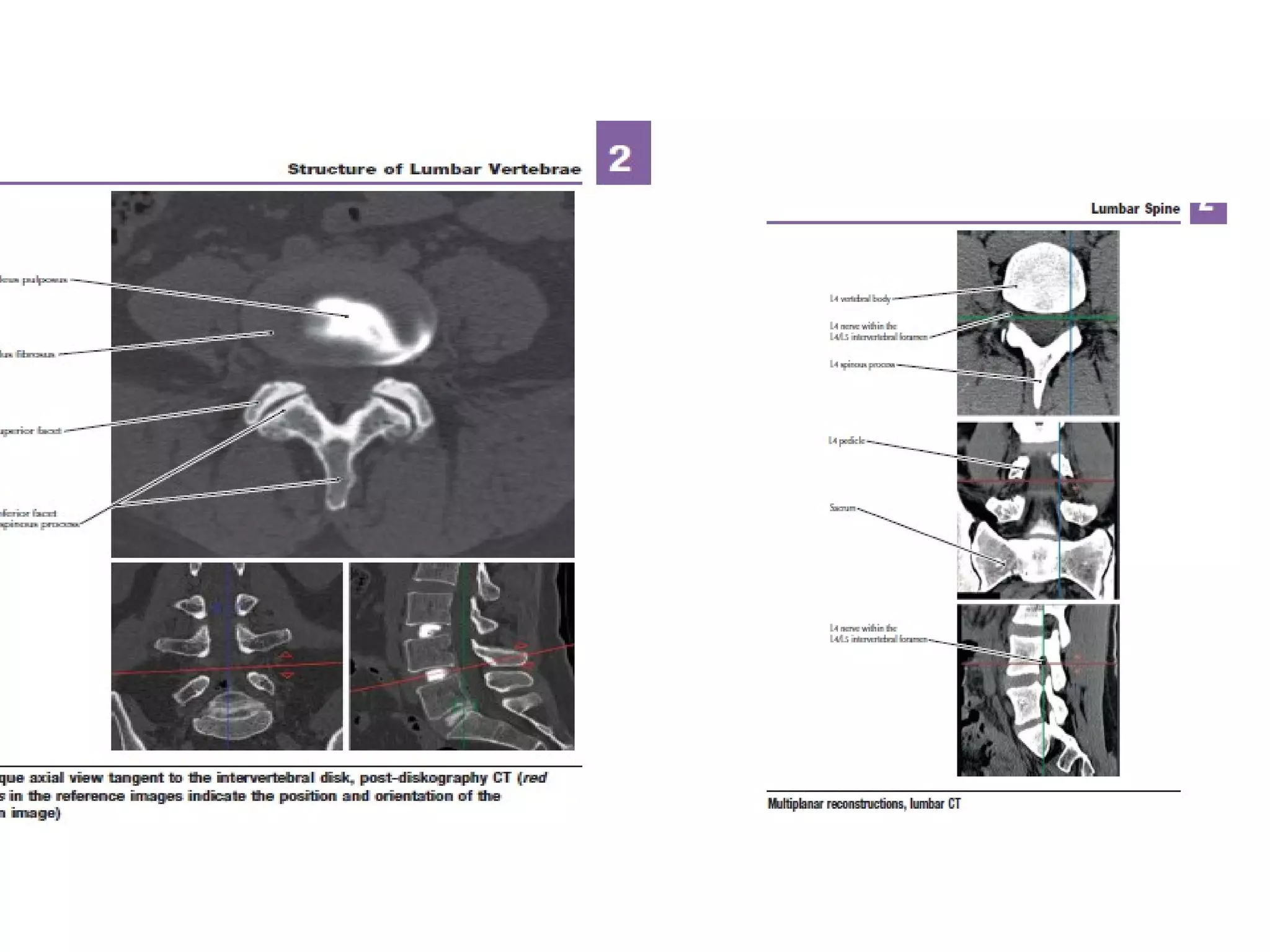 Omurga anatomi̇si̇ | PPT