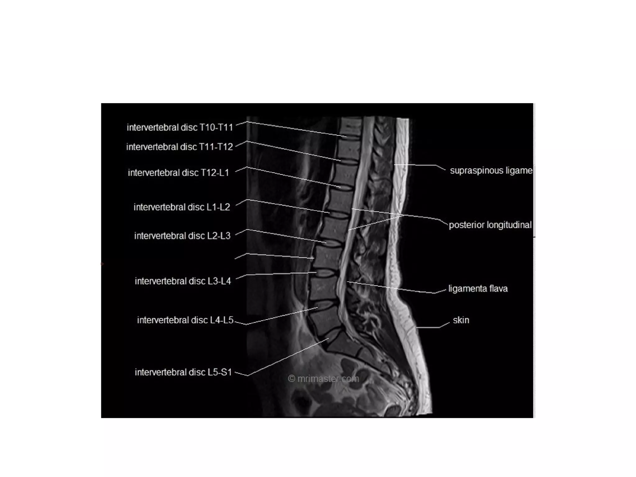 Omurga anatomi̇si̇ | PPT