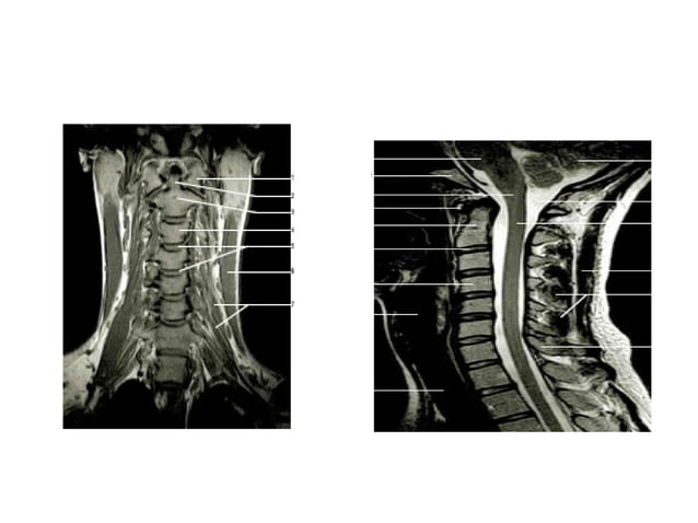 Omurga anatomi̇si̇ | PPT