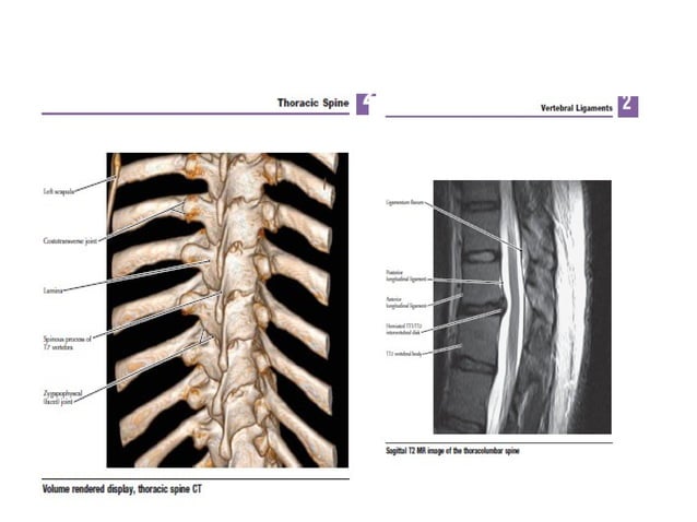 Omurga anatomi̇si̇ | PPT
