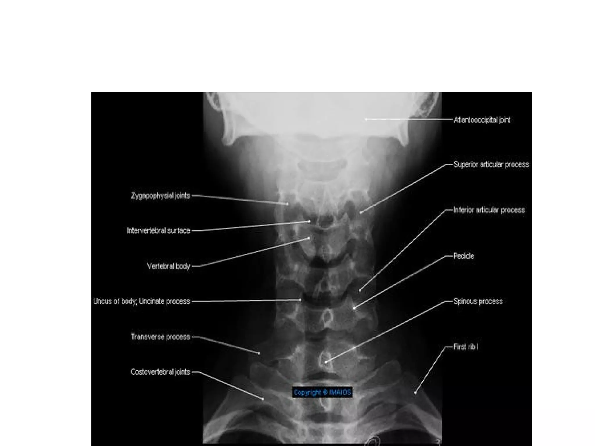 Omurga anatomi̇si̇ | PPT