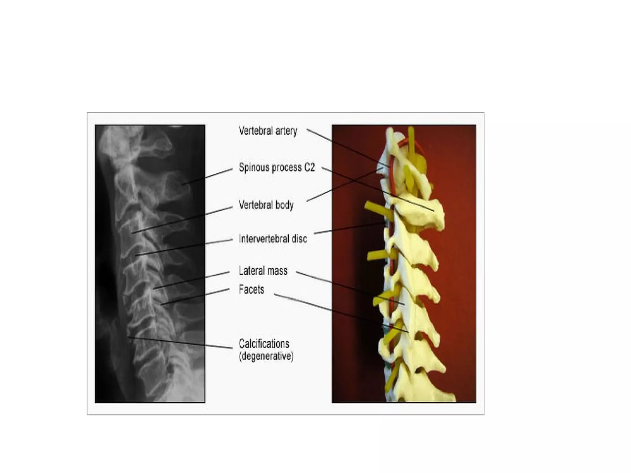 Omurga anatomi̇si̇ | PPT