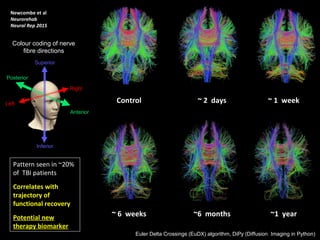 Managing ICP in Traumatic Brain Injury | PPT