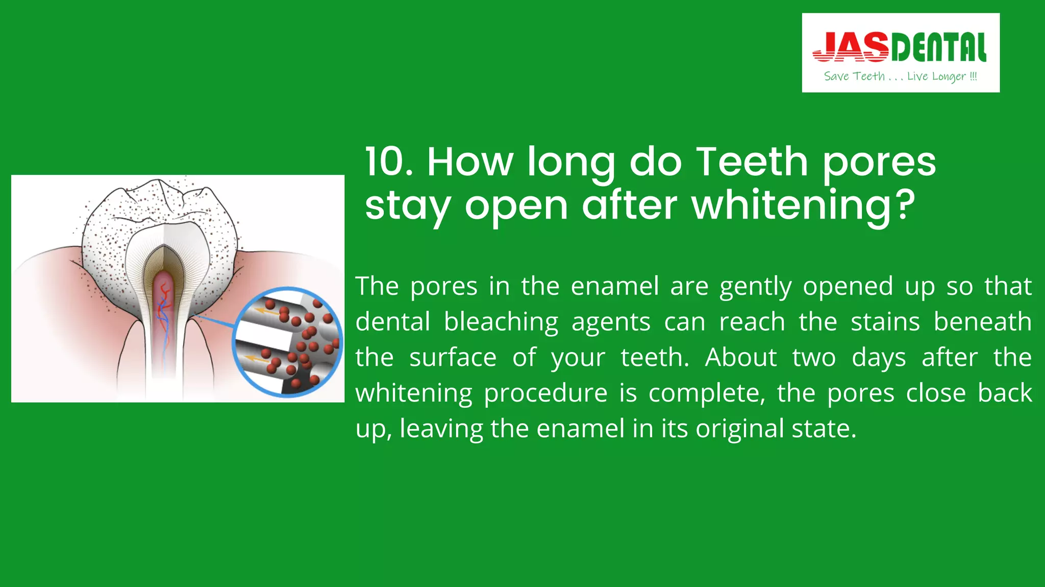 Teeth Whitening Questions | PDF