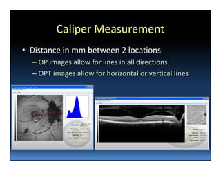 FPRC_ONC_contest_slides | PDF