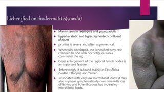 Onchiocerciasis in ethiopia | PPTX