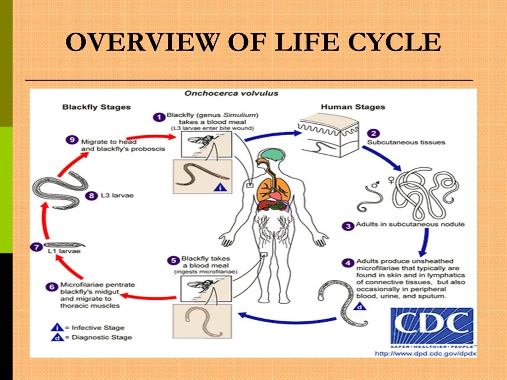 Onchocerca volvulus