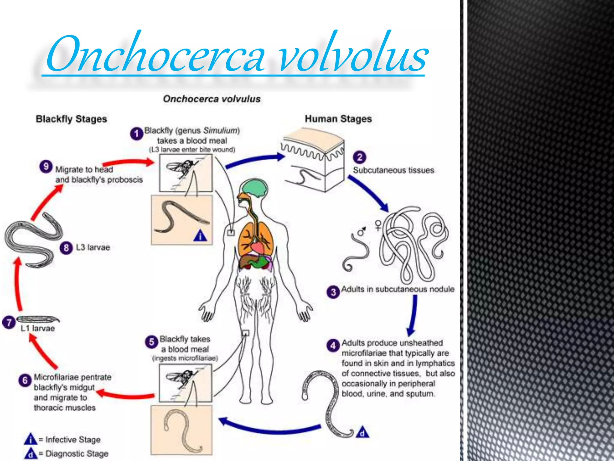 Onchocerca volvulus | PPTX