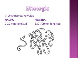 Onchocerca volvulus | PPTX