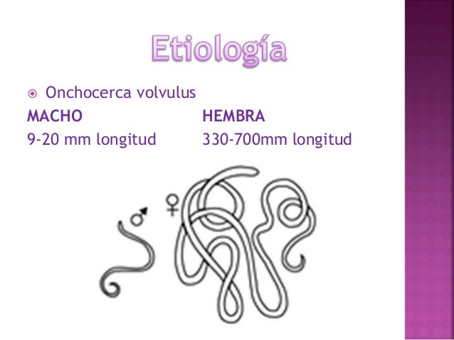 Onchocerca volvulus