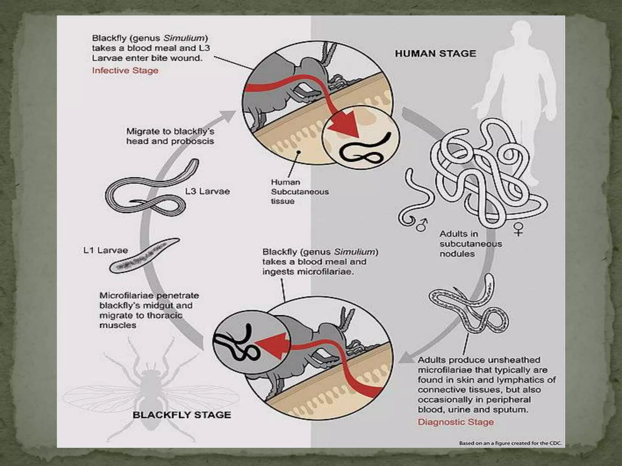 Onchocerca volvulus | PPTX