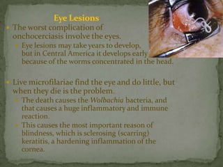 Onchocerca volvulus | PPTX