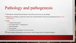 Onchocerciasis | PPTX