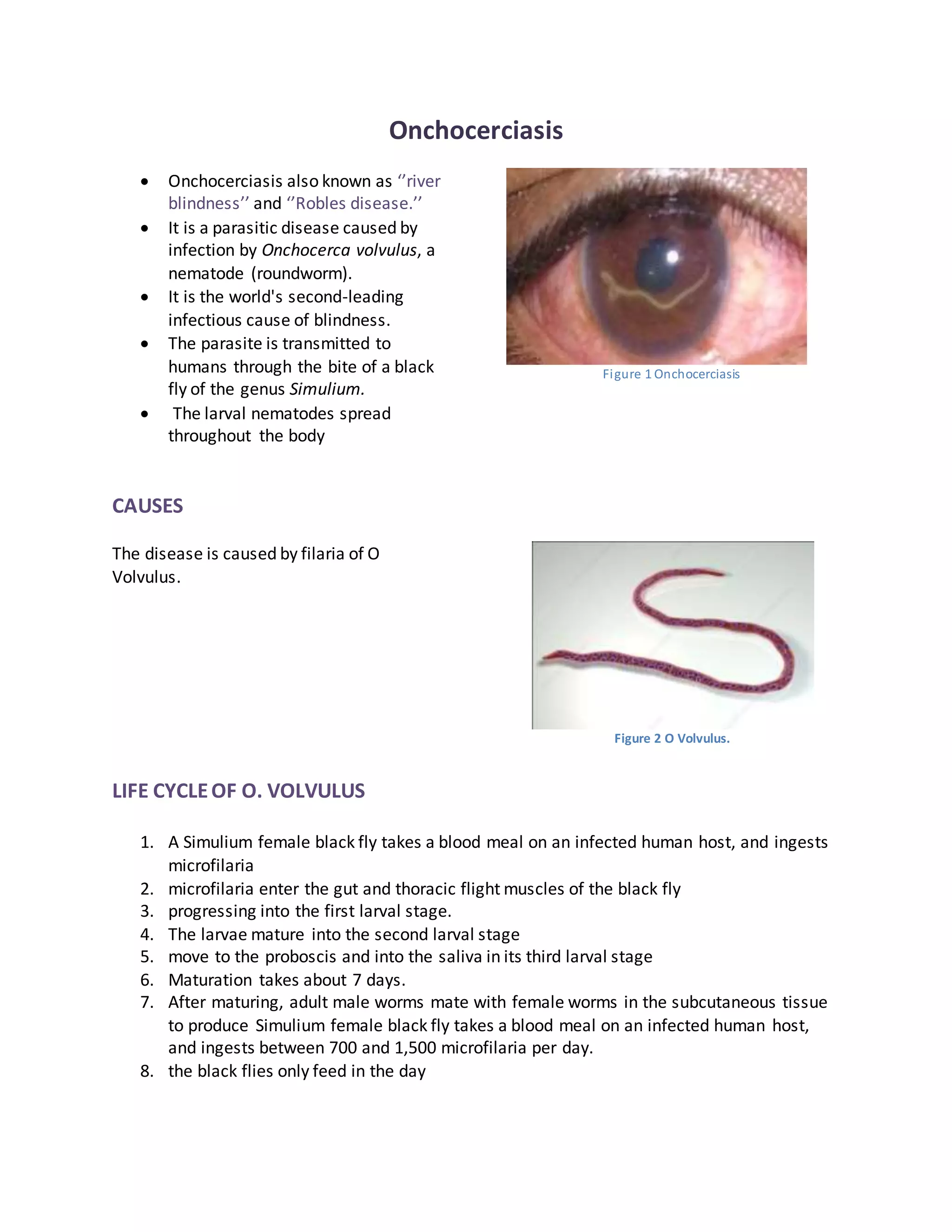 Onchocerciasis | DOCX