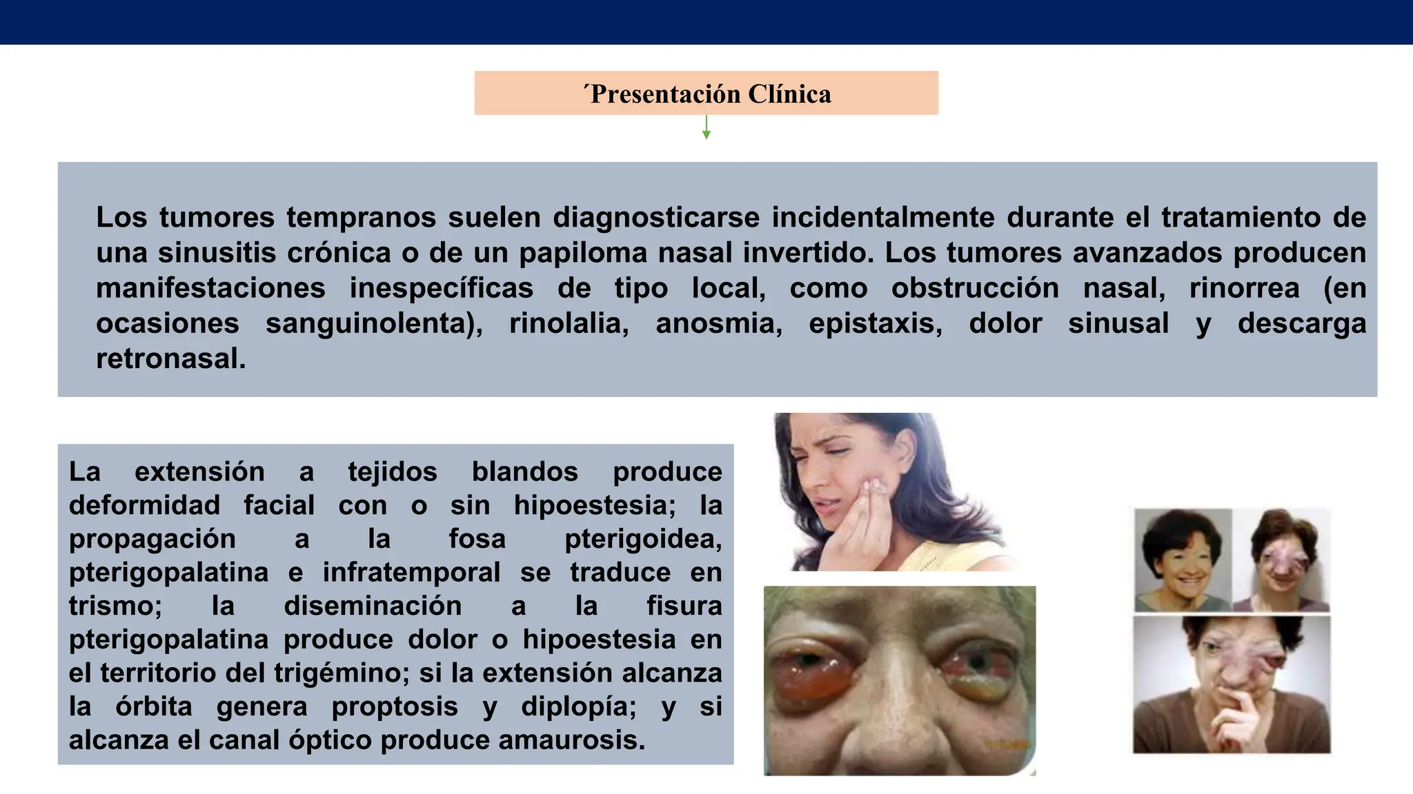 Cancer de cavidad nasal y senos paranasales | PPTX