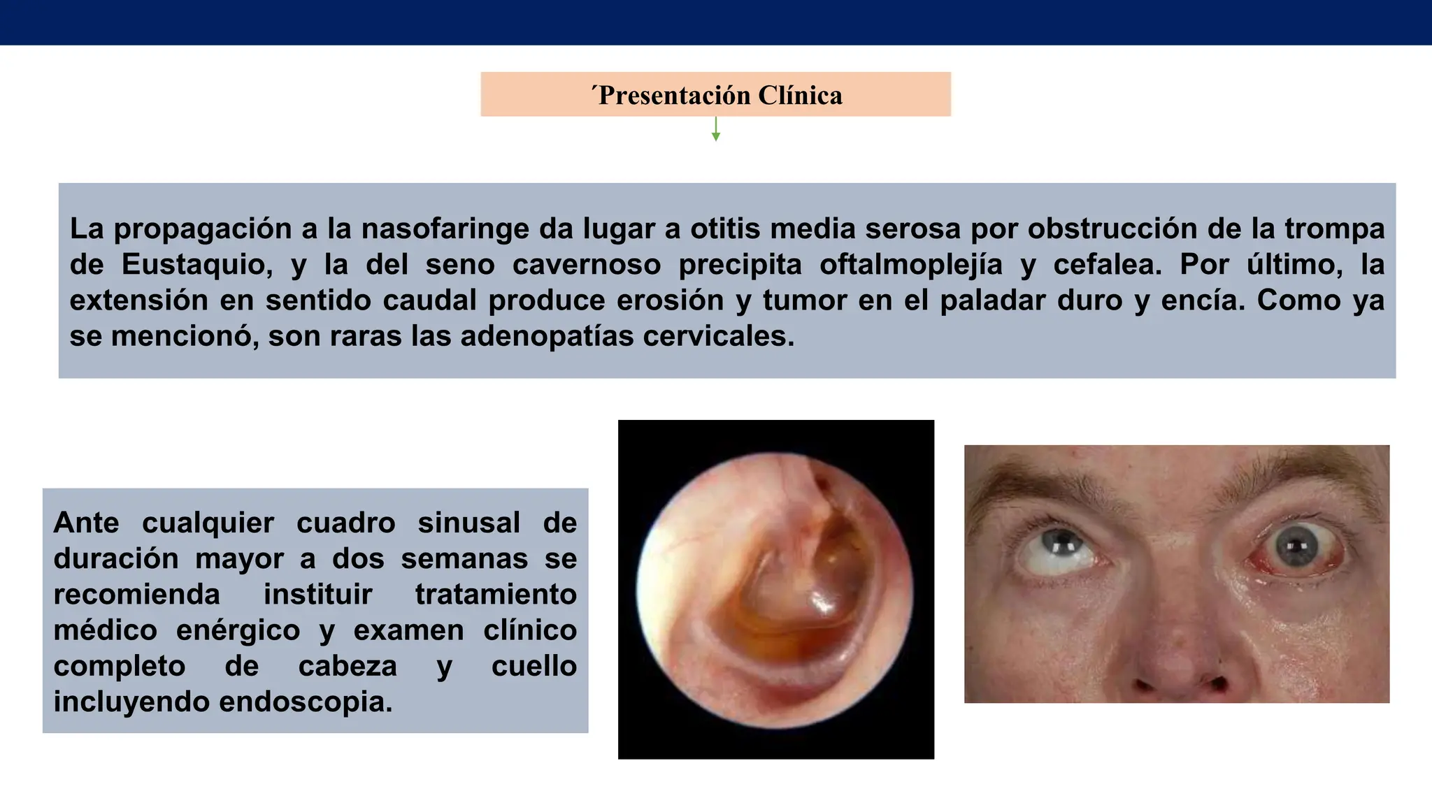 Cancer de cavidad nasal y senos paranasales | PPTX