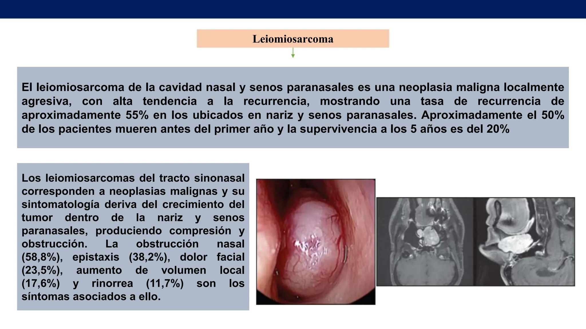 Cancer de cavidad nasal y senos paranasales | PPTX