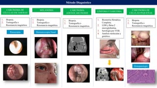 Cancer de cavidad nasal y senos paranasales | PPTX