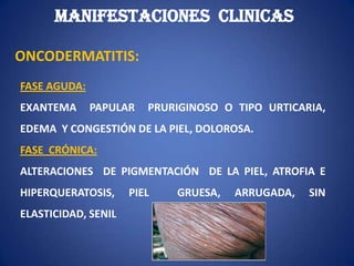 Oncocercosis | PPTX