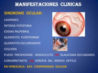 Oncocercosis | PPTX