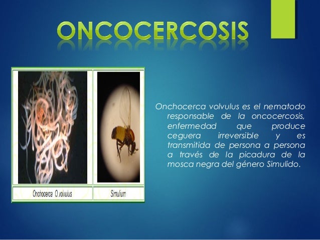 Oncocercosis