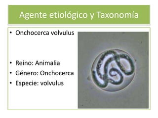 Oncocercosis. | PPTX
