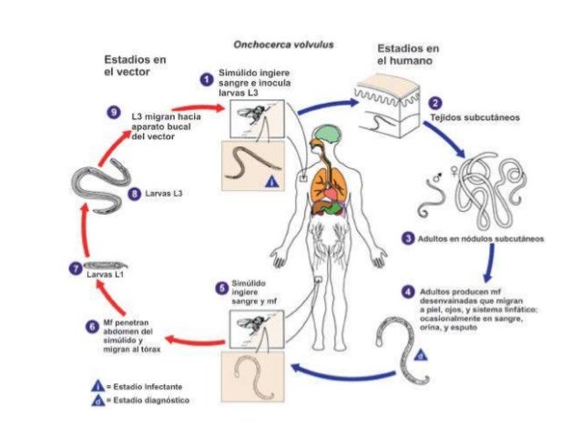 Oncocercosis.
