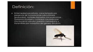 ONCOCERCOSIS.pptx
