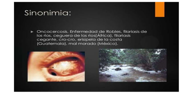 ONCOCERCOSIS.pptx