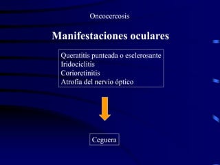 Oncocercosis abril 27.ppt