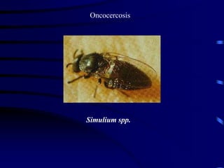 Oncocercosis abril 27.ppt