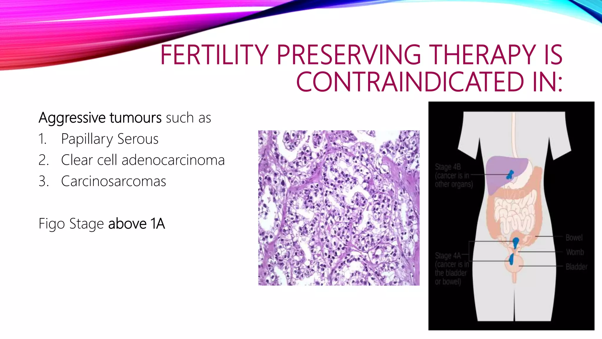 Oncofertility | PPTX