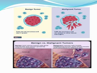 Oncogenesis / Carcinogenesis | PPT