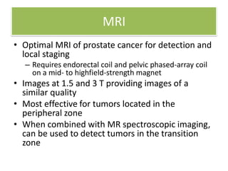 Oncoimaging: prostate cancer | PDF