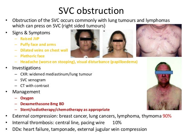 Oncological Emergencies