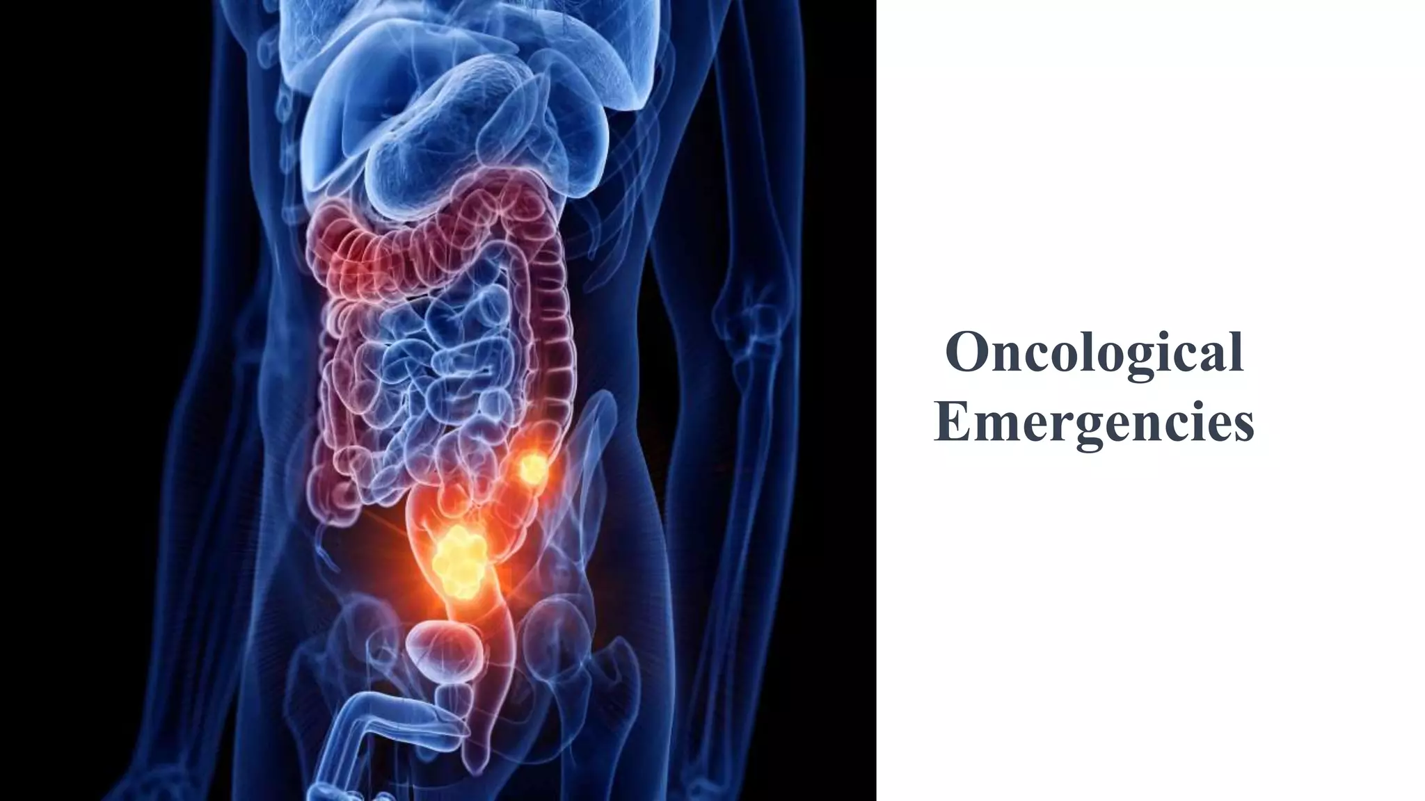 Oncological Emergencies & Treatment Modalities.pptx
