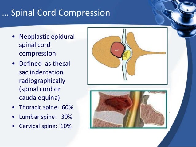 Oncologic emergencies asim